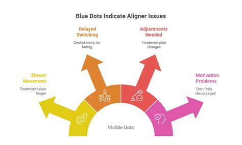 What Are The Compliance Indicators In Invisalign Teen Comfort Dental