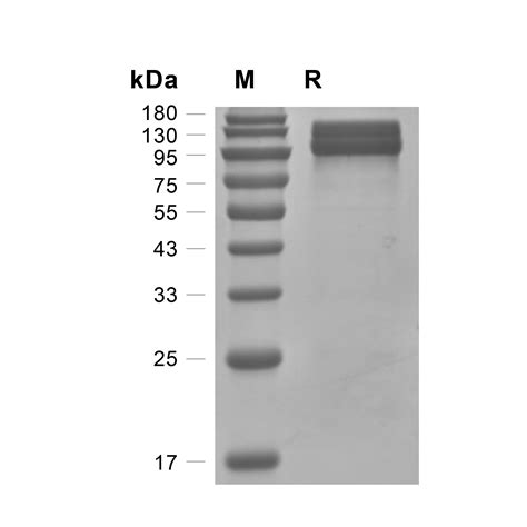 Integrin Alpha V Beta 6蛋白 Human Hek293 His Mce