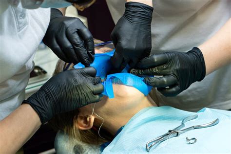 Isolate Patient S Teeth With Rubber Pad Stock Image Image Of