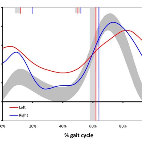 pdf the conventional gait model the success and limitations