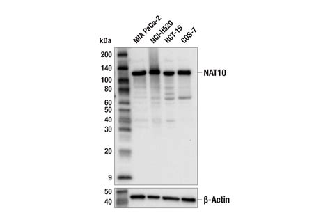 Nat10 E5u9w Rabbit Mab Cell Signaling Technology