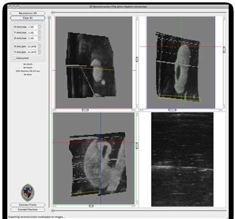 Screenshot Of The 3d Reconstruction Module On Mac Os X Showing A 3d Download Scientific