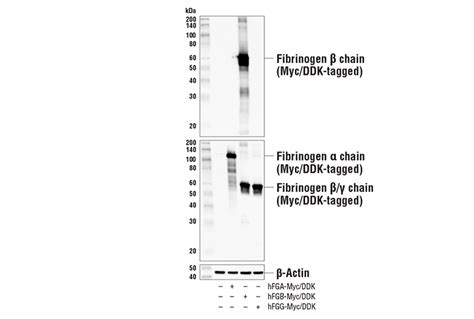 Fibrinogen Beta Chain Antibody Cell Signaling Technology