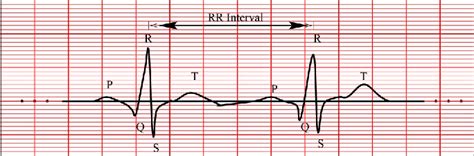 Figure From A Patient Adaptive Profiling Scheme For ECG Beat Classification Semantic Scholar