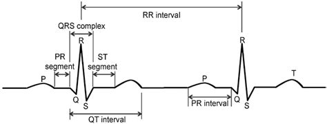 Main Features In Ecg Signal Download Scientific Diagram