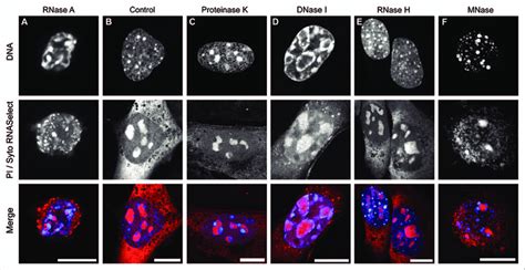 Interphase Chromatin Distributions After Exposure To Different Download Scientific Diagram