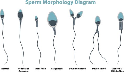 Illustration Of Sperm Morphology Diagram 66822781 Vector Art At Vecteezy