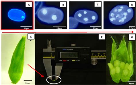 Determination Of Microspore Developmental Stage Cytological Download Scientific Diagram