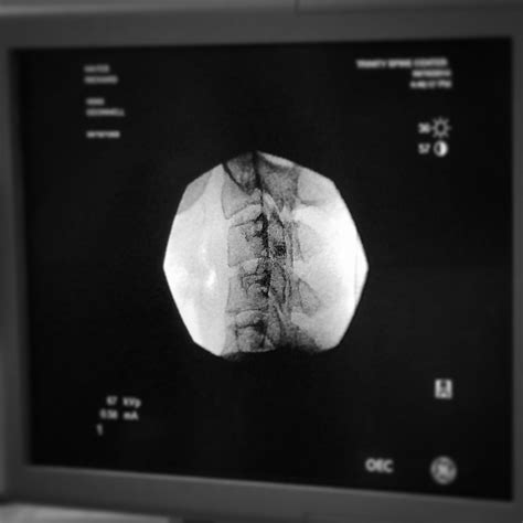 Peripheral Nerve Block Imaging Richard W Hayes My Journey With God