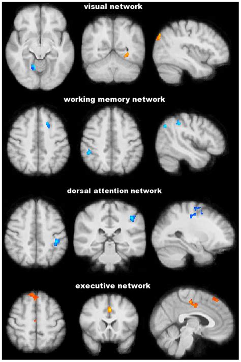 Functional Connectivity Analysis At The Level Of Resting State Download Scientific Diagram