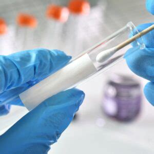 STD Testing Southwest WomanCare OBGYN