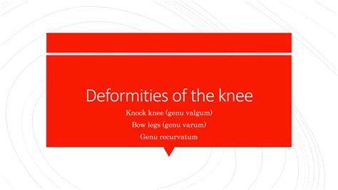 Deformities Of The Knee Pptx