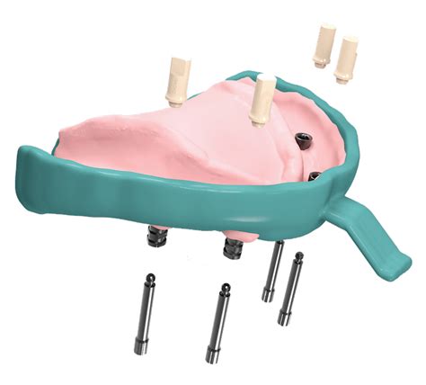 Multi Unit Scan Body Dynamic Abutment Solutions