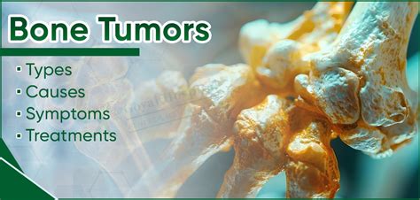 Symptoms Of Bone Lesions What Are The Possible Causes And Treatments