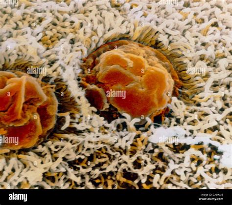 False Colour Scanning Electron Micrograph Sem Of The Wall Of The Large Intestine Colon