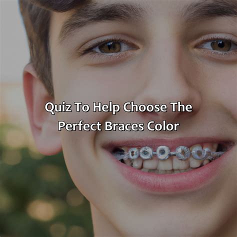What Color Braces Should I Get Quiz
