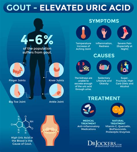 Gout Symptoms Causes And Natural Support Strategies Artofit