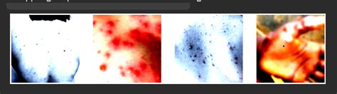 第j5周：densenetse Net实战 Csdn博客