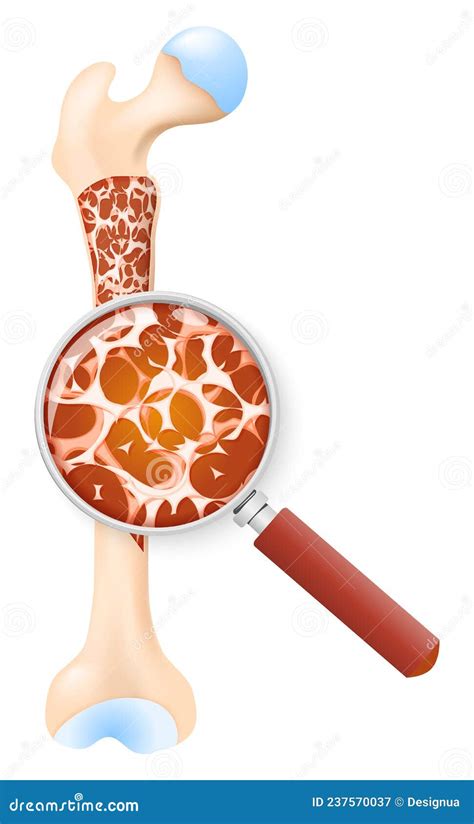 Bone Mass For Male And Female Age And Osteoporosis Chart Cartoon Vector