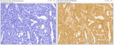 Imagej灰度值量化分析 实用技巧——免疫组化分析定量分析篇免疫组化定量分析imagej Csdn博客