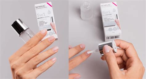 Onycholysis Of The Nails What Is It What Are The Causes And How To