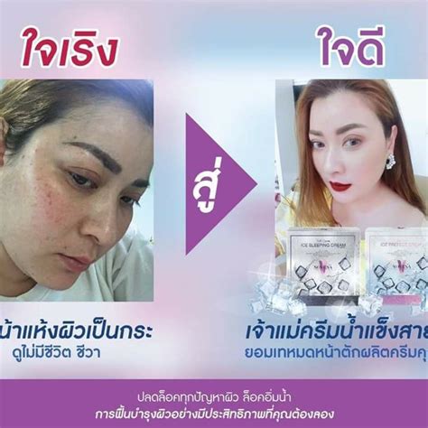 ครีมน้ำแข็ง Si Sa Ket