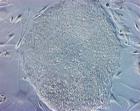 Stem Cells Light Micrograph Stock Image G Science Photo Library