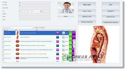 What Is A Bioplasm Nls Tomography Scanner 8d Nls 8d Lris 8d Nls