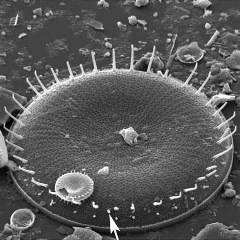 Image Stephanodiscusrimoportula Species Diatoms Of North America