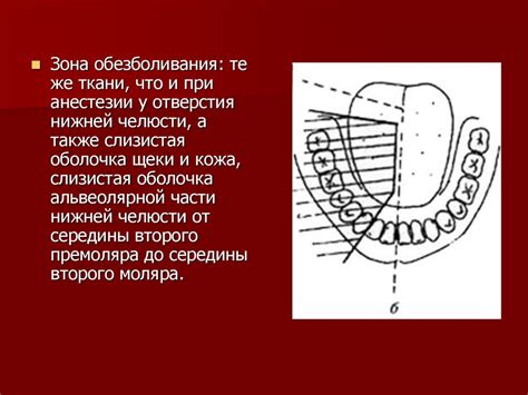 Обезболивание нижней челюсти презентация онлайн