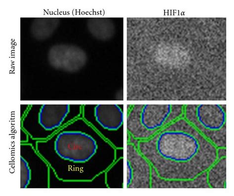 Cellomics Images Showing The Algorithm Used For Quantification Of Download Scientific Diagram