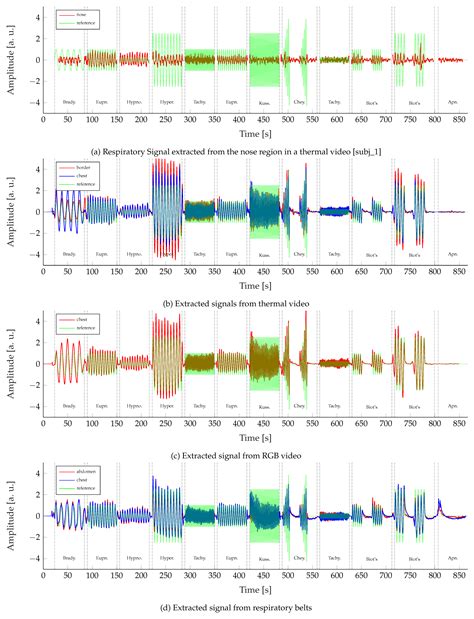 Kussmaul Breathing Pattern