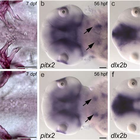 Fig S2 Ectopic Eda Expression Results In Supernumerary And Bicuspid