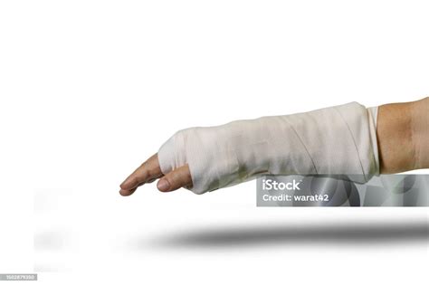 하얀 배경에 고립된 사고로 부러진 팔 부목 오려낸 경로 깨짐에 대한 스톡 사진 및 기타 이미지 깨짐 석고 건축자재 손목 Istock