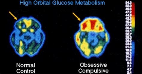 대한민국 20~30대 강박장애로 불안에 떨고 있다