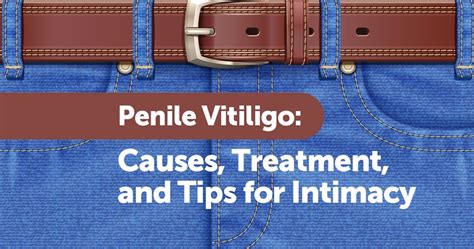 Penile Vitiligo Causes Treatment And Tips For Intimacy Myvitiligoteam