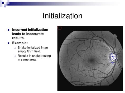 Ppt Active Contours Technique In Retinal Image Identification Of The Optic Disk Boundary