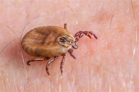 Tick Bites How To Avoid Them And What To Do If You Get Bitten Bbc