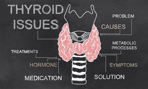 Common Thyroid Conditions In Men Ismc Hormones