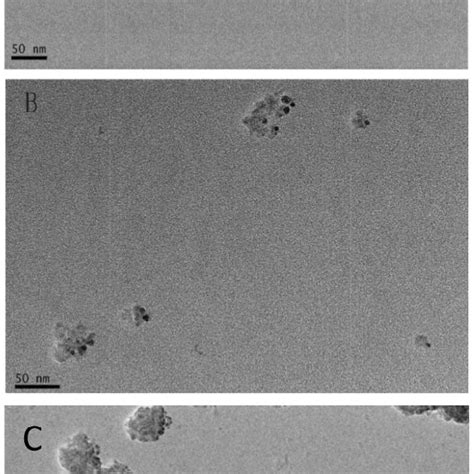 Shape And Size Distribution Of The Urinary Exosomes Exosomes Were