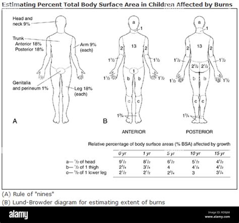 Lund And Browder Chart For Burns
