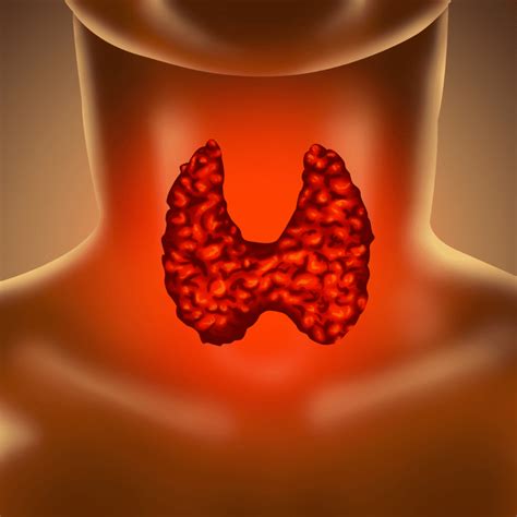 Top 8 Foods To Prevent Thyroid Cancer Mlc