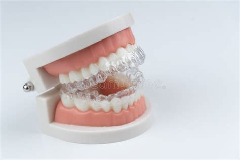 Invisible And Removable Aligners For Teeth Alignment Stock Image Image Of Removable Dental