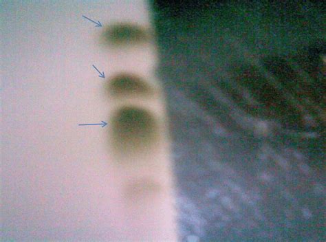 Thin Layer Chromatography Plate Of Three Distinct Compounds Download