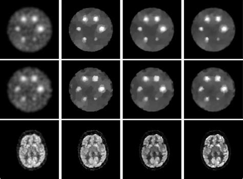 Sparsity Promoting Regularization For Effective Noise Suppression In Spect Image Reconstruction