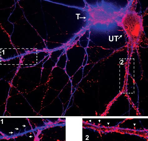 Reorganization Of The Actin Cytoskeleton In Dendrites Of Stau2 Download Scientific Diagram