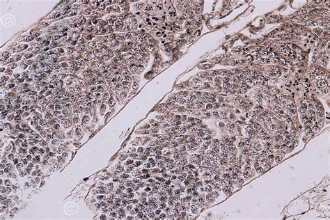 Grasshopper Testis Under The Microscope In Lab Stock Image Image Of Grasshopper Leptotene