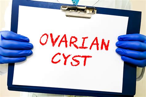 How To Know If You Have An Ovarian Cyst A Guide For Women In Cumming Ga Blog For North