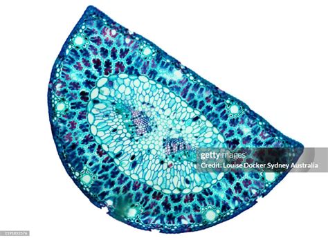 Cross Section Of Leaf Microscope