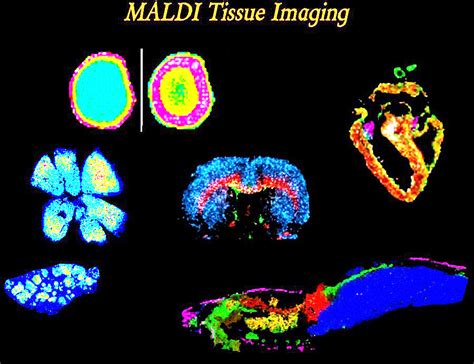 Spatially Resolved Proteomics And Imaging Mass Spectrometry Msrc Schey Lab Vanderbilt University